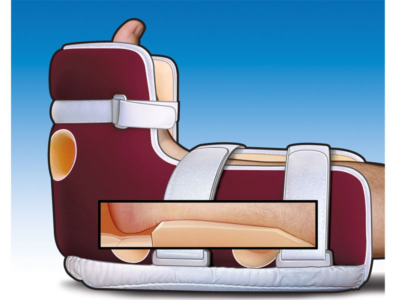 Heelift Glide Boot: Lightweight Heel Protection