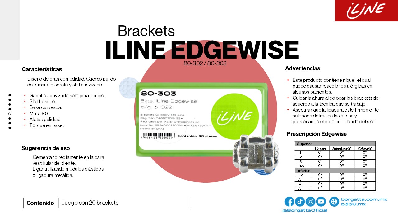 Brackets Edgewise